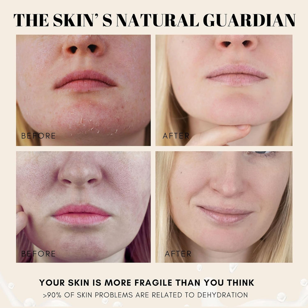 Beef Tallow for Skin Care, Grass Fed Beef Tallow & Honey Balm – All-Na ...